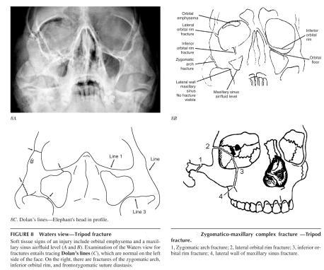 Medicine Decoded: Lines of Dolan and the elephants of Rogers
